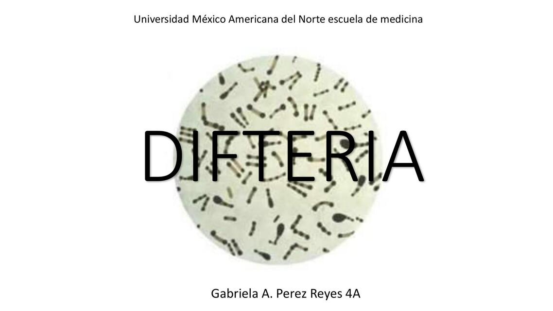 Flashcards de difteria Mp | Por Rodiz | uDocz