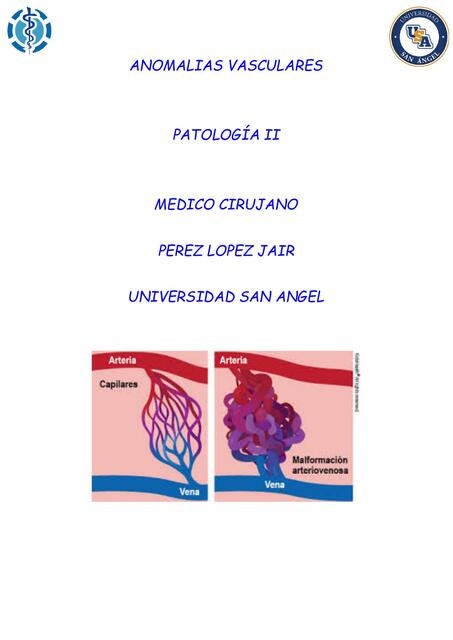 Flashcards de ANOMALIAS VASCULARES | Por Jair Pérez | uDocz