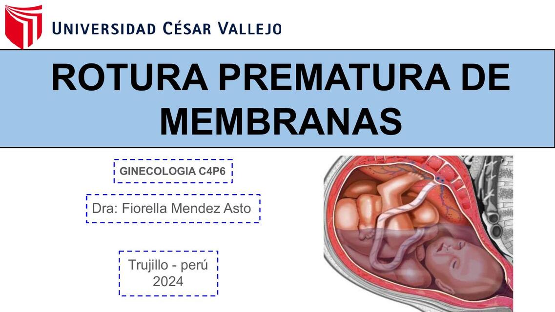 RPM | brenda garcia mostacero | uDocz