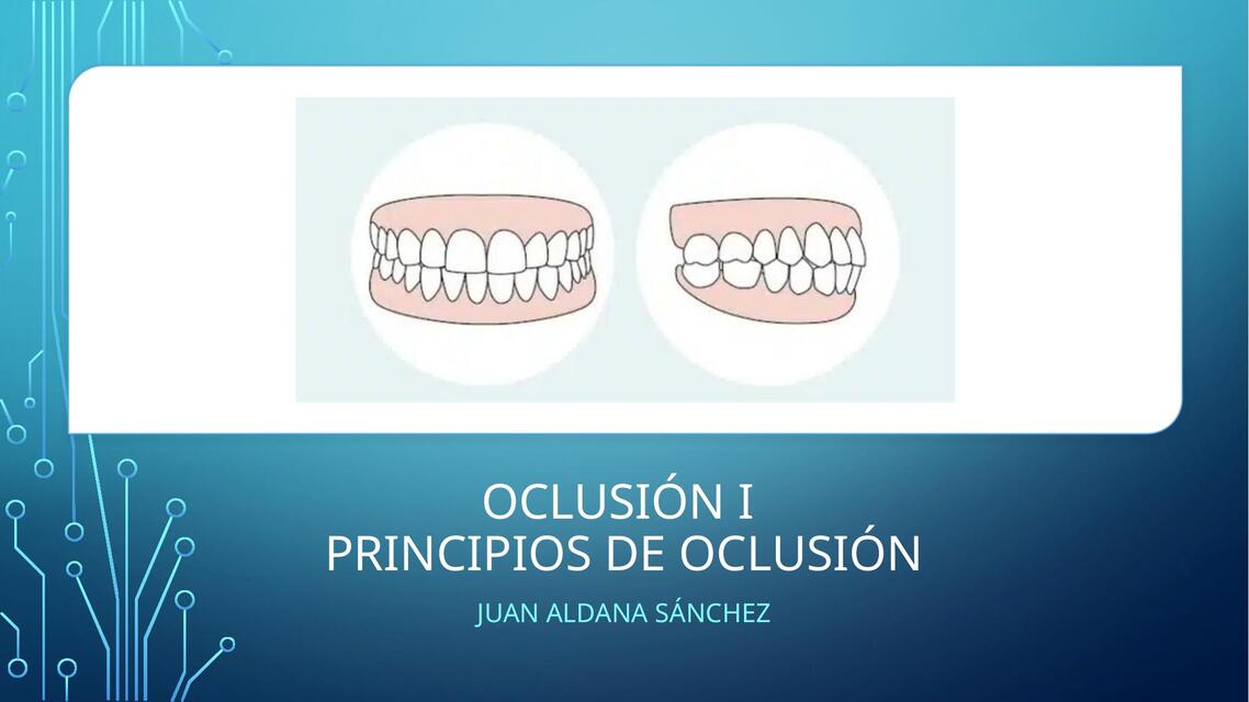 Oclusión 1 | juan aldana sanchez | uDocz