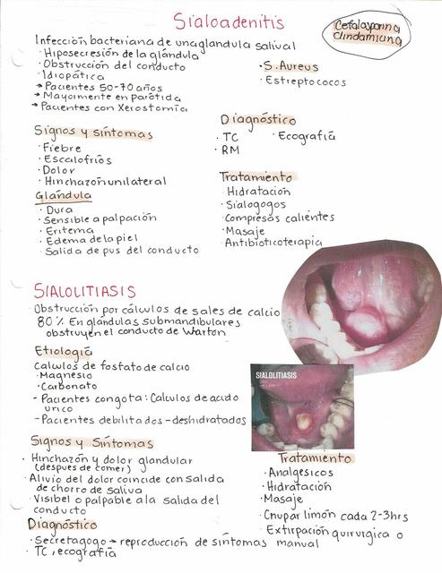 Sialoadenitis y sialolitiasis | Fer Yan Márquez | uDocz
