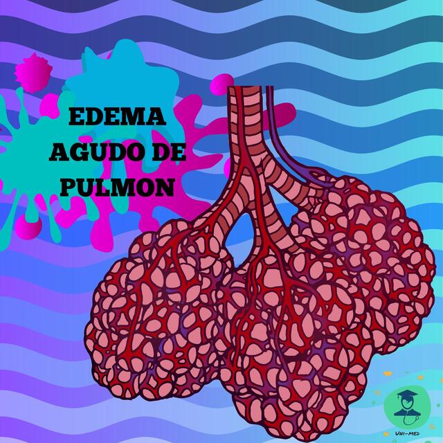 EDEMA AGUDO DE PULMON | UNI - MED | uDocz