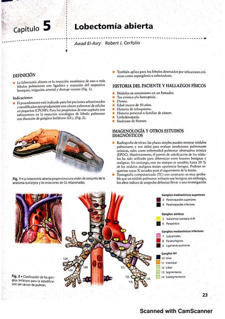 Lobectomía Pulmonar | Angeles Coll | uDocz