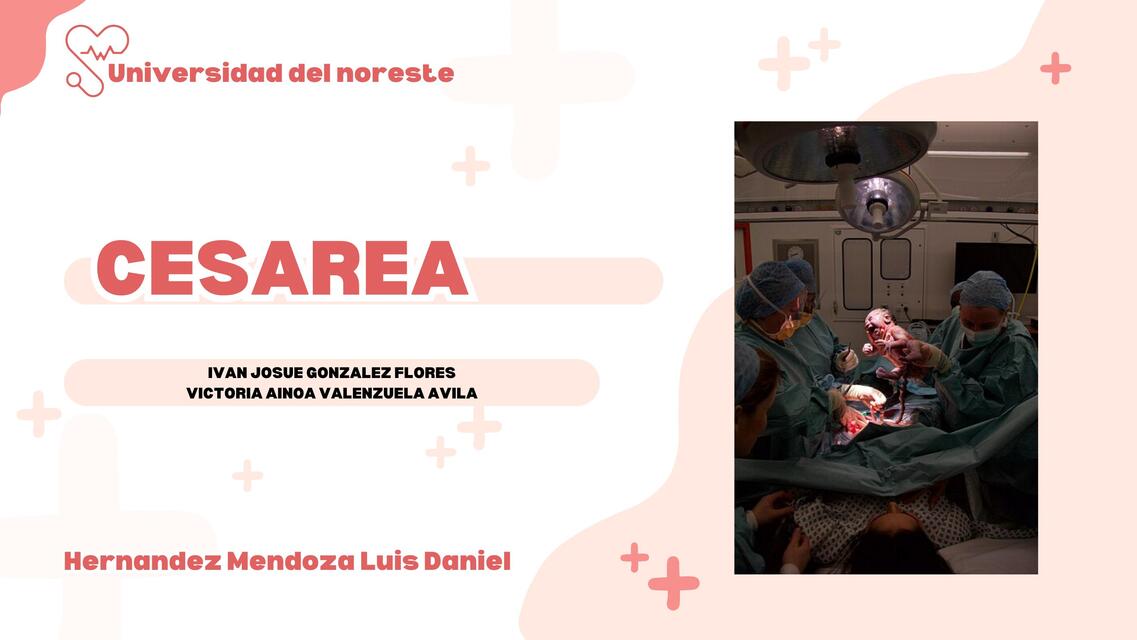 Cesarea | IVAN JOSUE GONZALEZ FLORES | uDocz