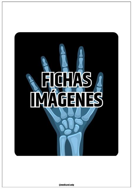 ACV | Caroline | uDocz