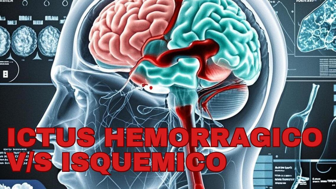 ICTUS hemorragico vs isquemico | Elisabet Jara | uDocz
