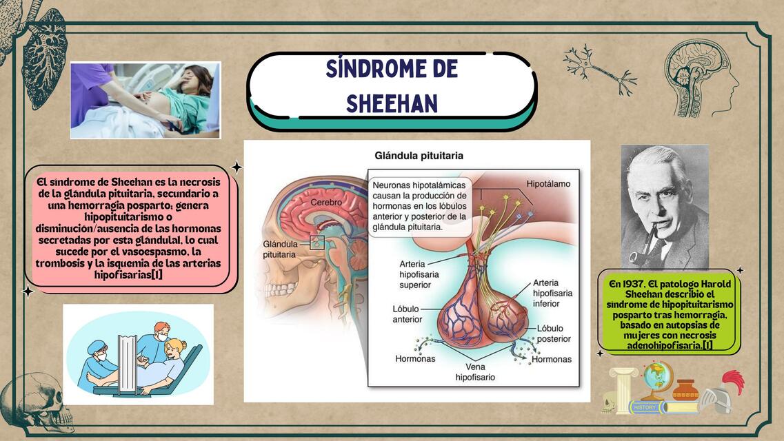 Sindrome de sheehan t | 1 ciclo | uDocz