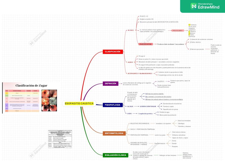 ESOFAGITIS CAUSTICA | MARÍA CASTRO | uDocz