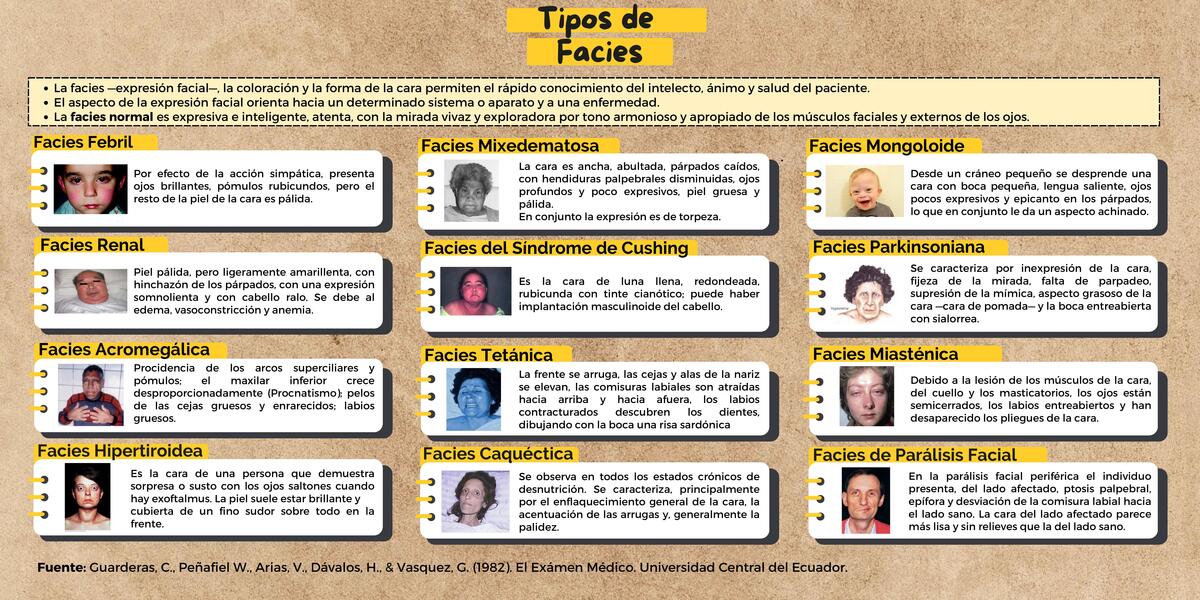 Tipos de facies | Angie | uDocz