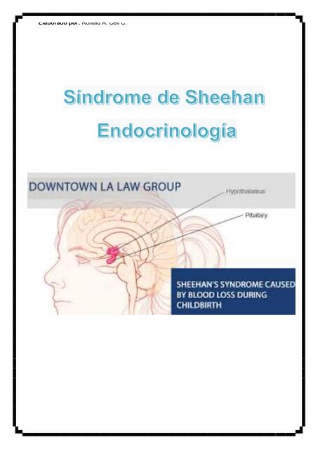Resumen rápido del Síndrome de Sheehan para parciales de Endocrinología ...