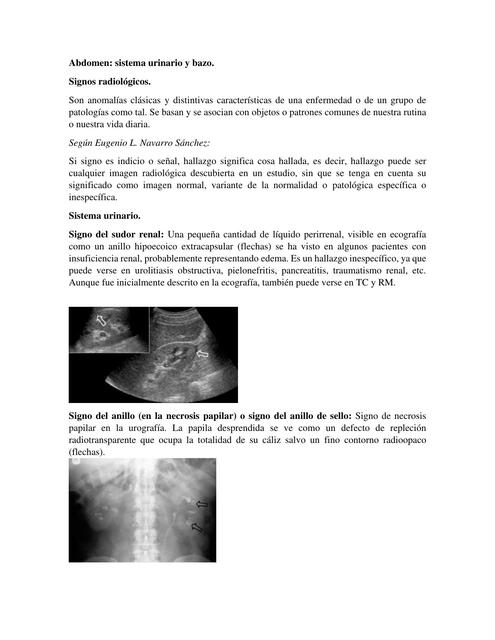 Signos radiológicos de abdomen: sistema urinario y bazo | Bethzaida | uDocz