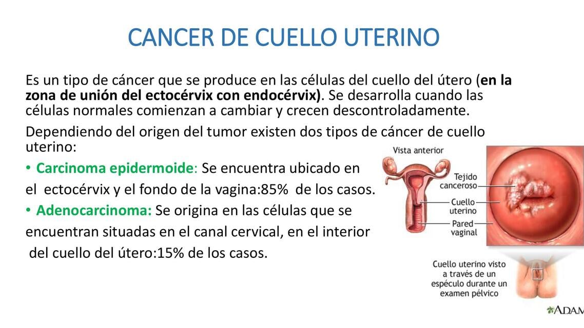 cuello uterino | karina | uDocz