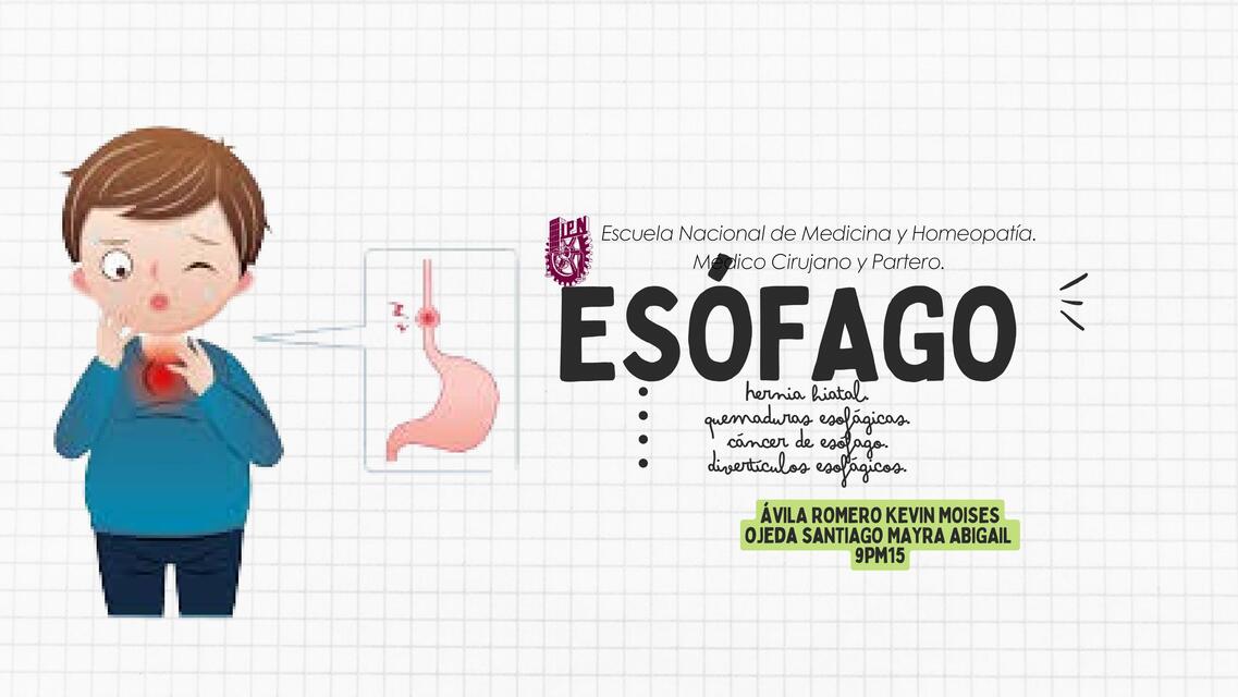 HERNIA HIATAL, CÁNCER DE ESÓFAGO, DIVERTÍCULOS ESOFÁGICOS. | Mayra | uDocz