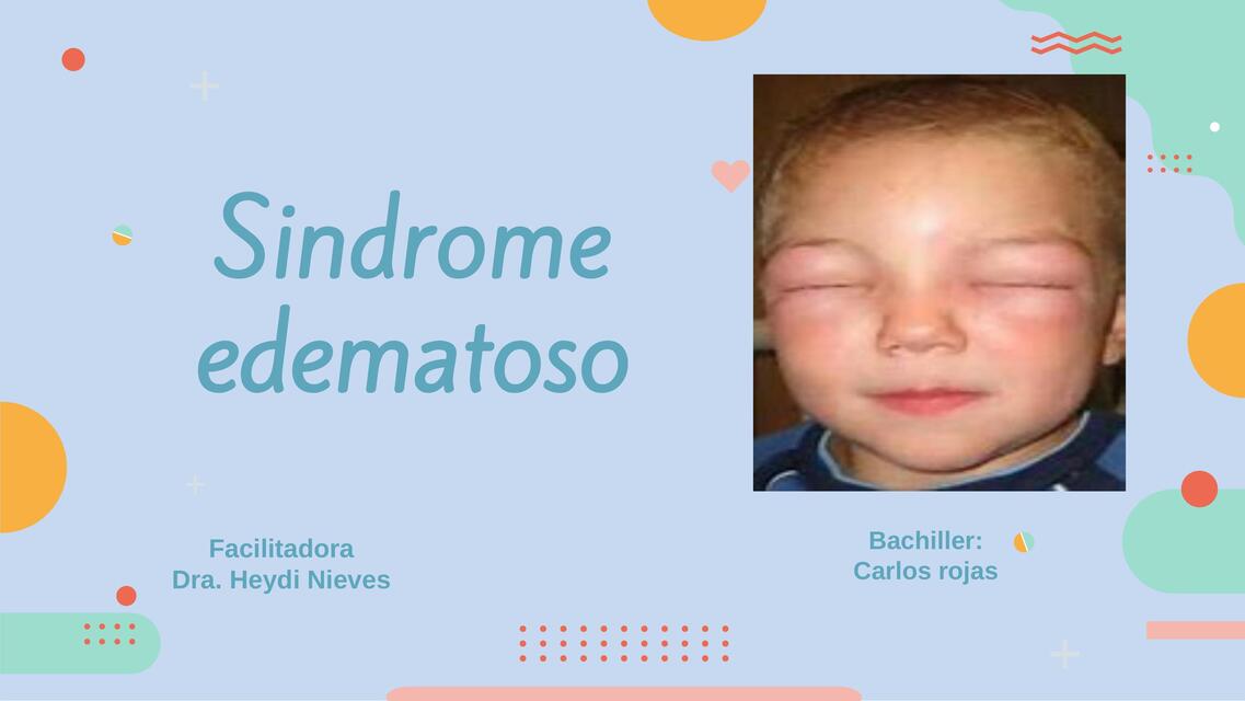 Tema N 16 Sindrome Edematoso | Javier Sánchez | uDocz