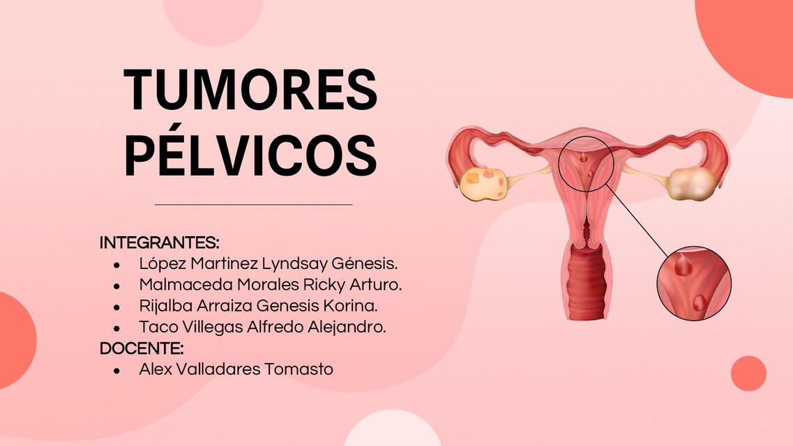 TUMORES PÉLVICOS GRUPO 4 GÍNECO TEORÍA | Genesis Rijalba | uDocz