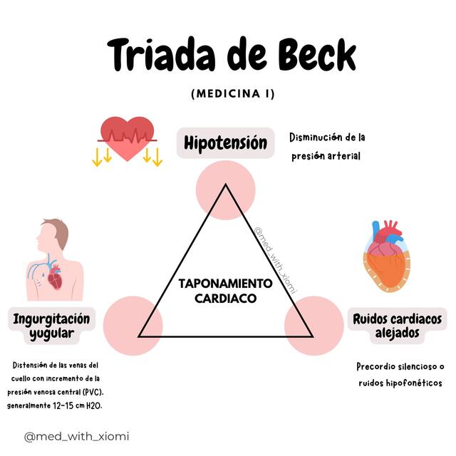 TRIADA DE BECK | Xiomara Cabellos 🩺 ️ | uDocz