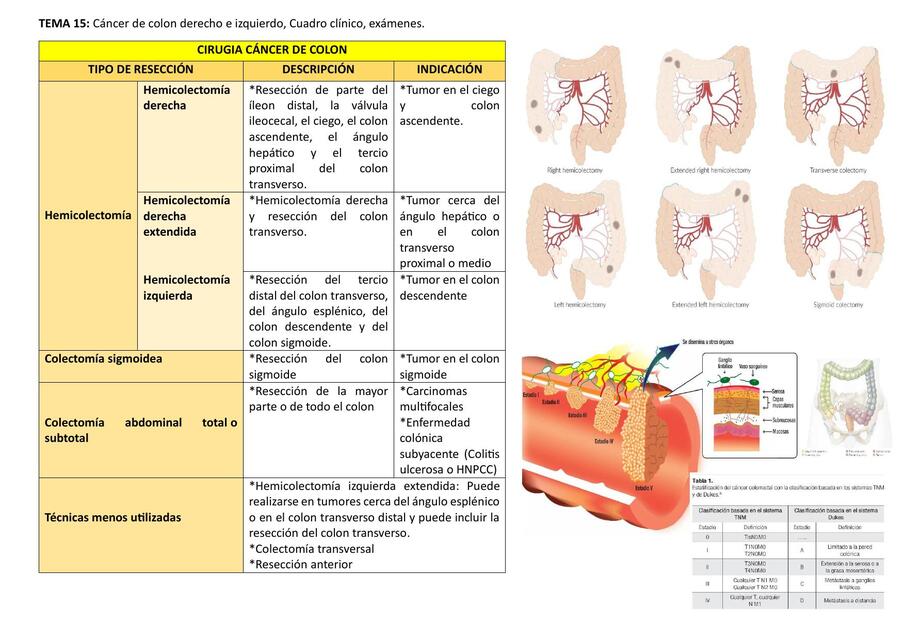 CANCER DE COLON - CIRUGIA | Brenda | uDocz