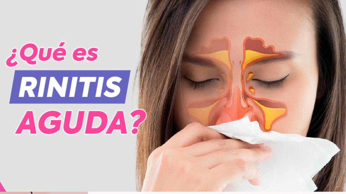 Rinitis Aguda | Dalyska Torres | uDocz