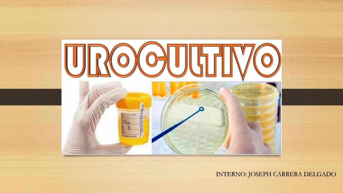 UROCULTIVO | Joseph Carrera | uDocz