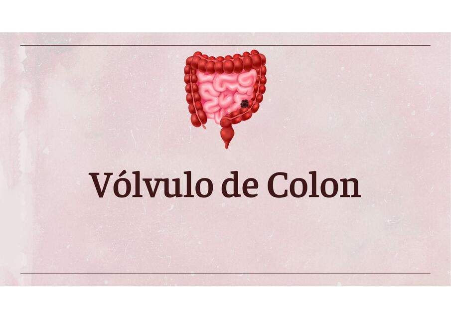 Vólvulo DE COLON | Eric | uDocz