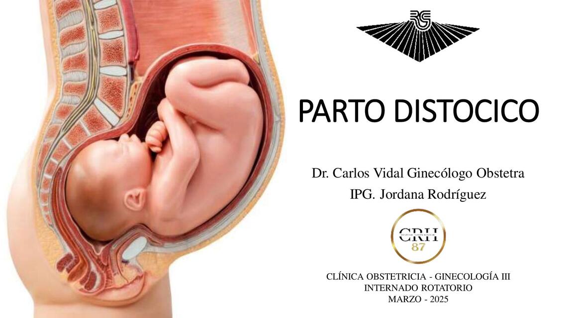 PARTO DISTOCICO | Jordana | uDocz