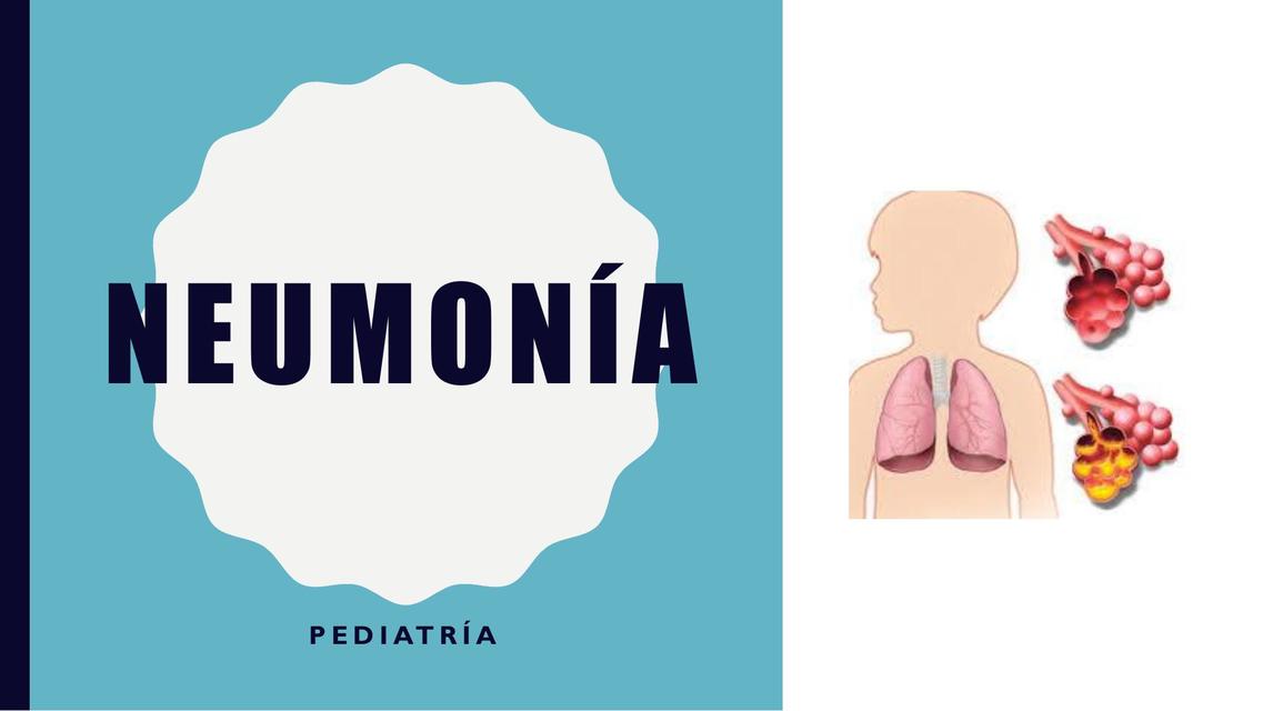 Evaluación de Neumonía en Pediatría | Medicine for all | uDocz Evaluación de Neumonía en Pediatría | Medicine for all | uDocz