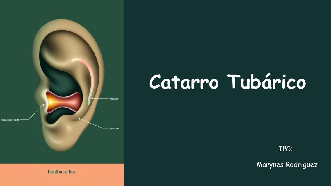 Catarro tubarico presen | Marynes Rodríguez | uDocz
