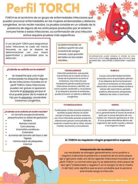 Perfil Torch | Jessica D. Martinez Martinez | uDocz