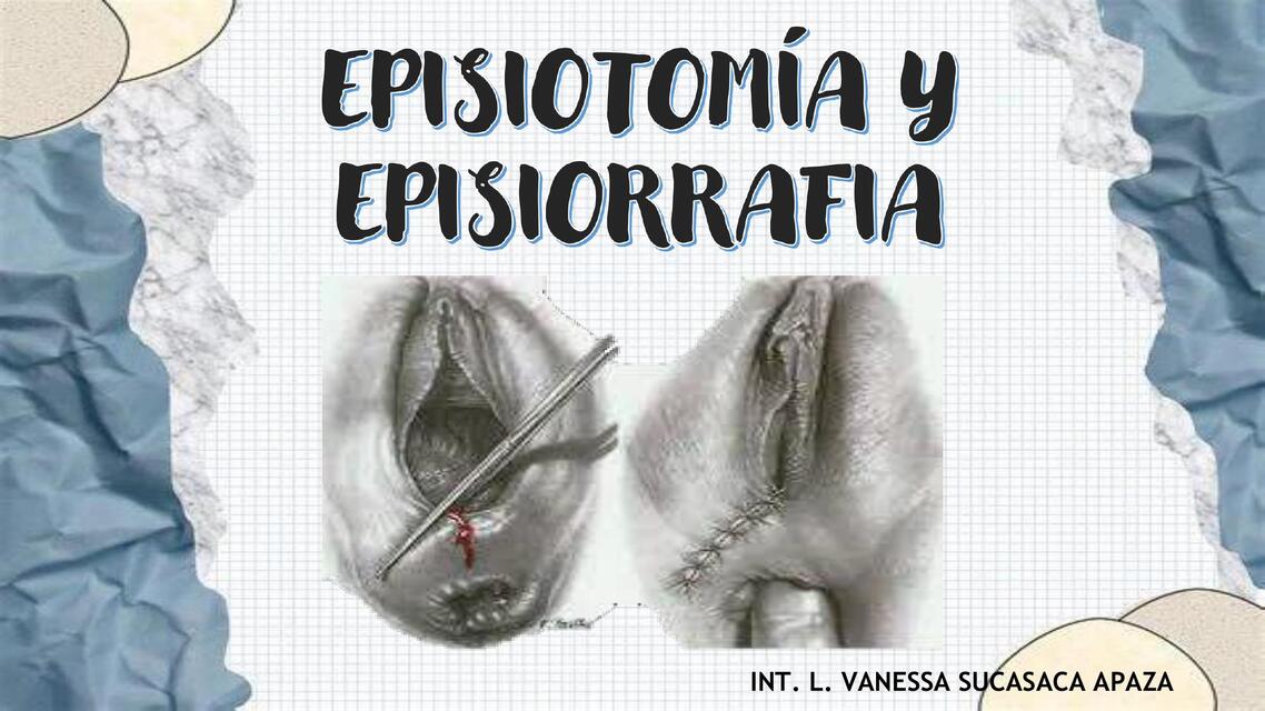 Episiotomia y episio | Lys vanessa Sucasaca apaza | uDocz