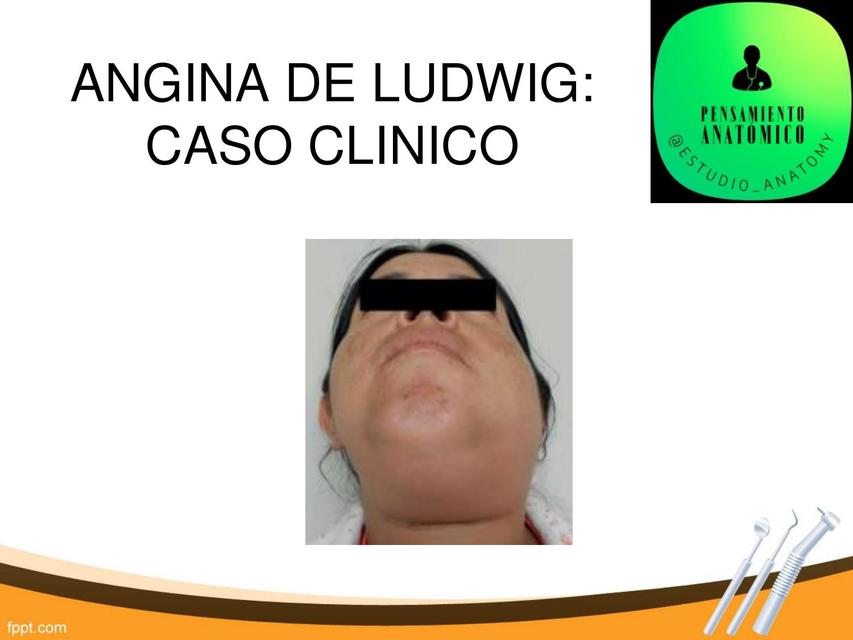ANGINA DE LUDWIG | PENSAMIENTO ANATÓMICO | uDocz