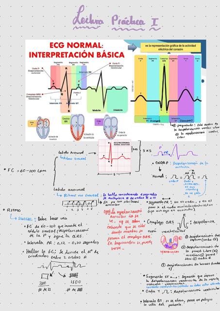 Ekg apunte | Ílla | uDocz