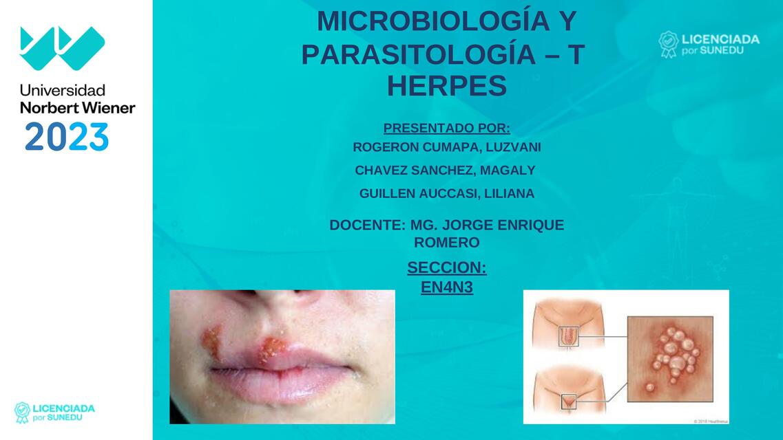 EXPOSICION MICROBIOLOGIA HERPES pptx 1 | Luzvani Rogeron | uDocz
