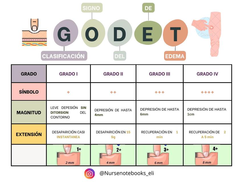 CLASIFICACIÓN DEL EDEMA (SIGNO DE GODET) | Elizabeth Ortiz O | uDocz