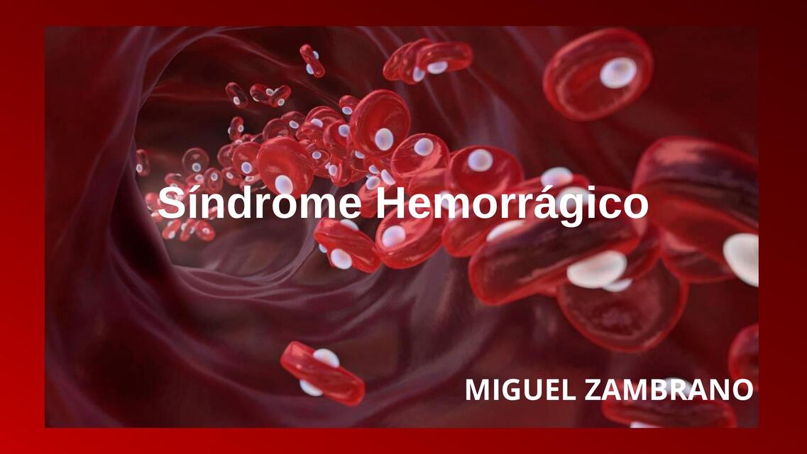sindrome hemorragico 2 0 pptx | David Guzman | uDocz