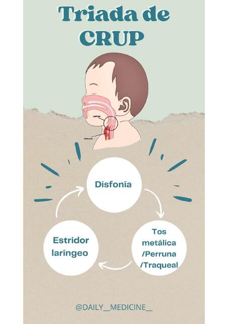 crup triada | Daily Medicine | uDocz