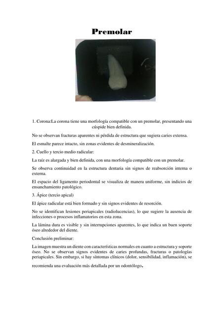 Premolar Abril Udocz