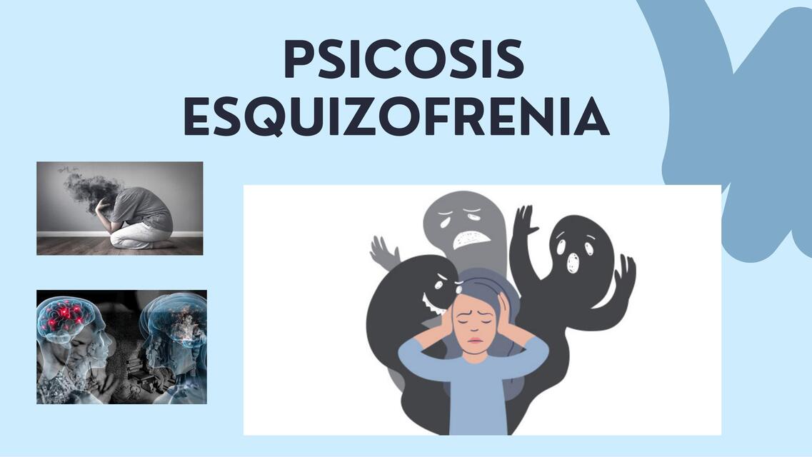 Ezquizofrenia | Alex Ayza | uDocz