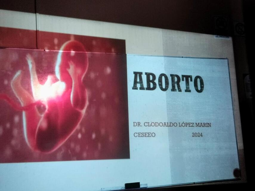 Aborto embrio | Diana Mendoza | uDocz