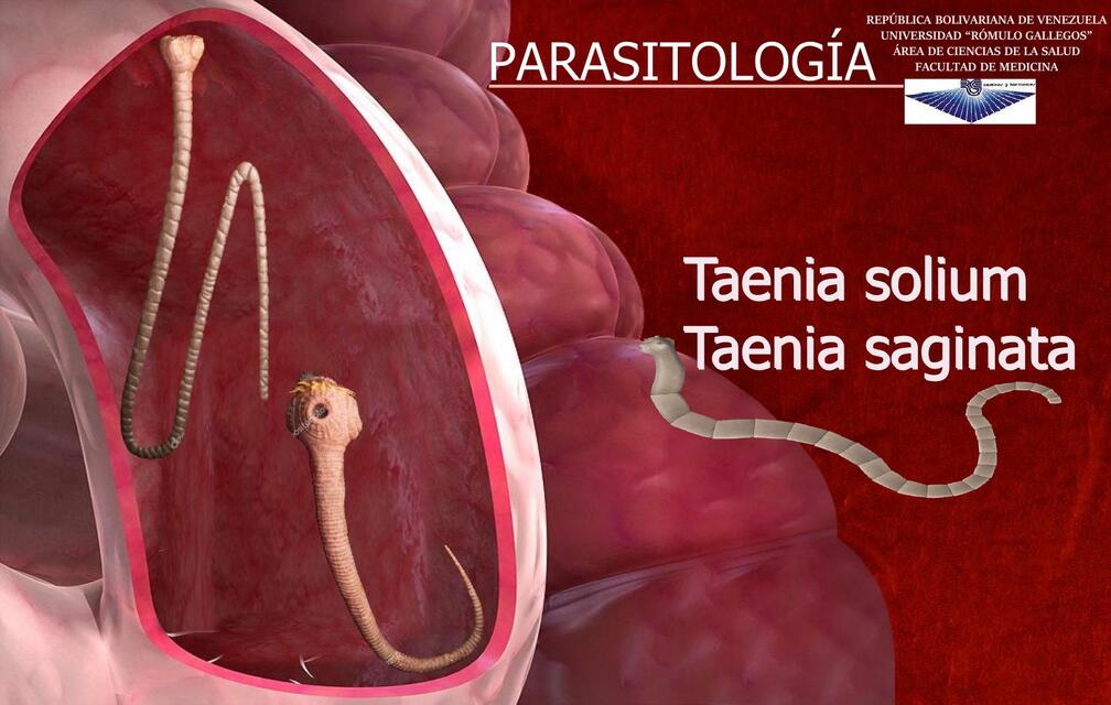 Tenía solium | Medic@ cla@ve | uDocz