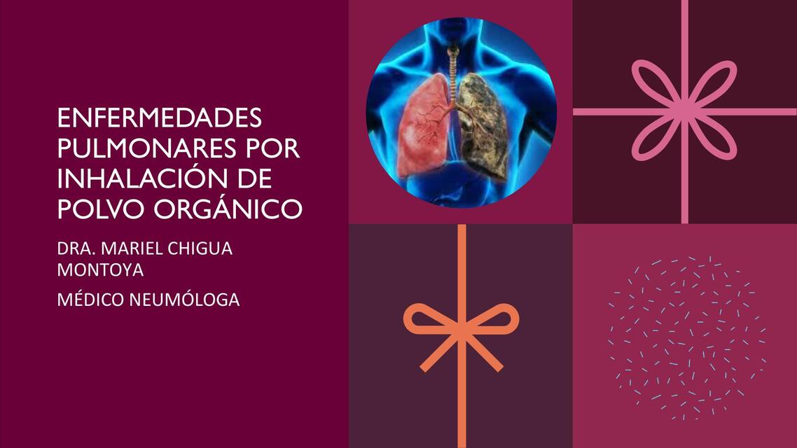 16 ENFERMEDADES PULMONARES POR INHALACIÓN DE POLVO | euge zarate | uDocz