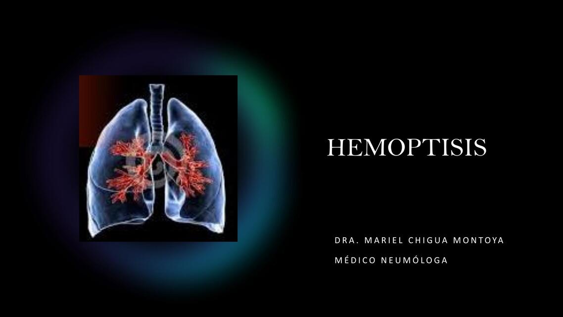 20 HEMOPTISIS | euge zarate | uDocz