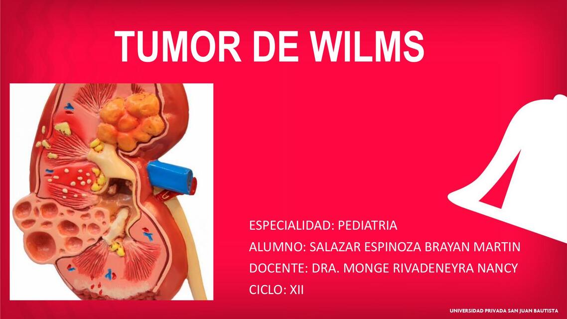 Tumor de Wilms Pediatria | XYC | uDocz