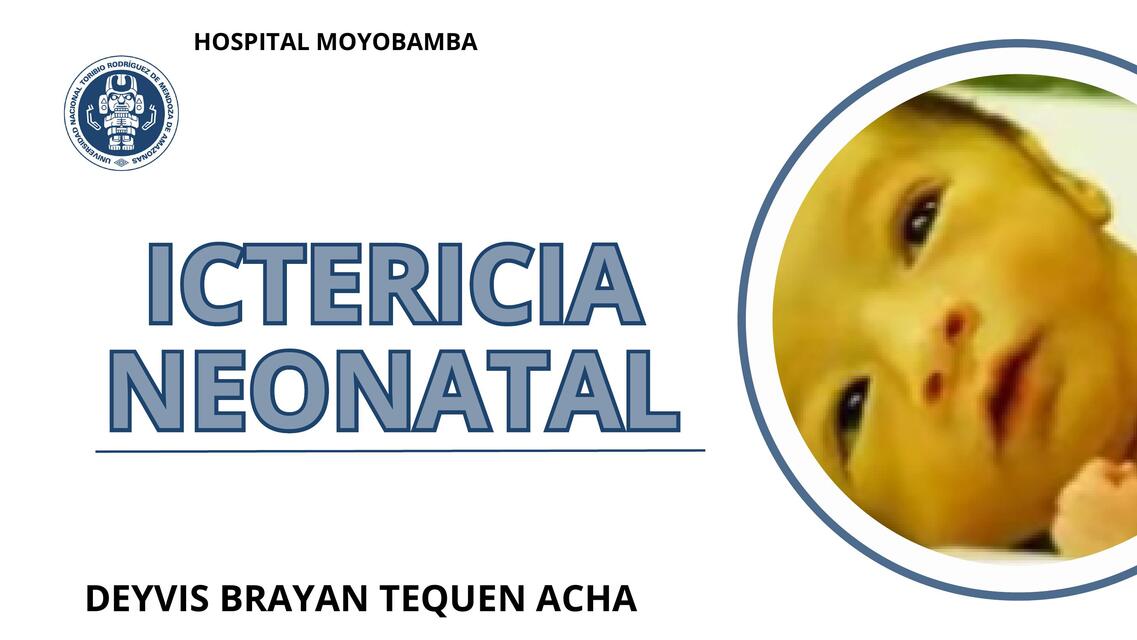 Flashcards de Ictericia neonatal | Por DEYVIS | uDocz