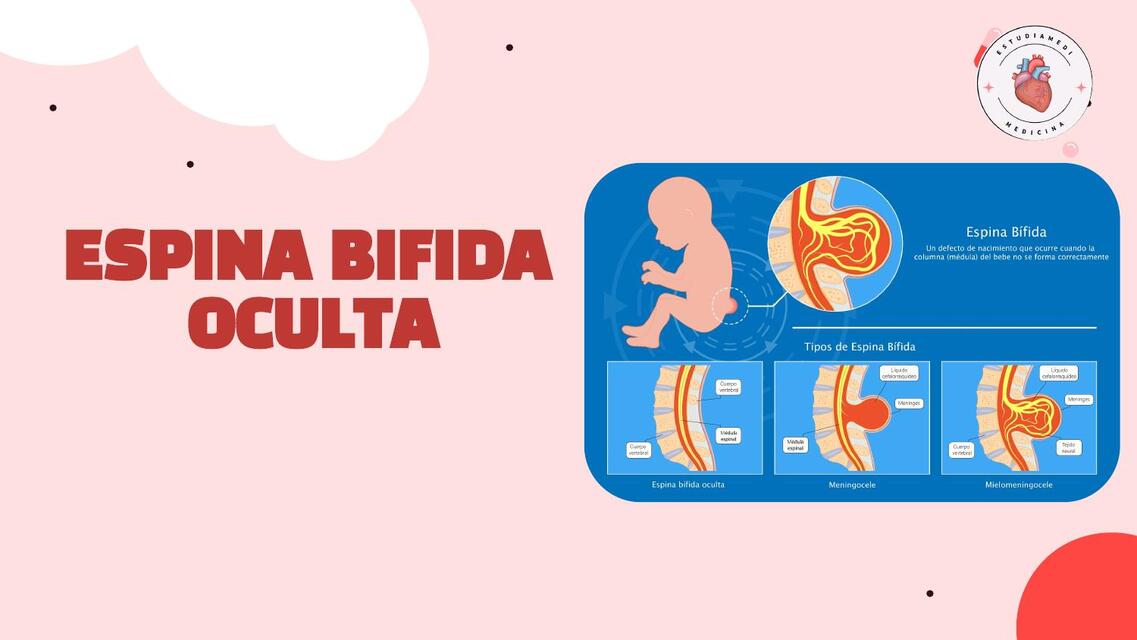 ESPINA BÍFIDA OCULTA | Estudiamedi Medicina | uDocz