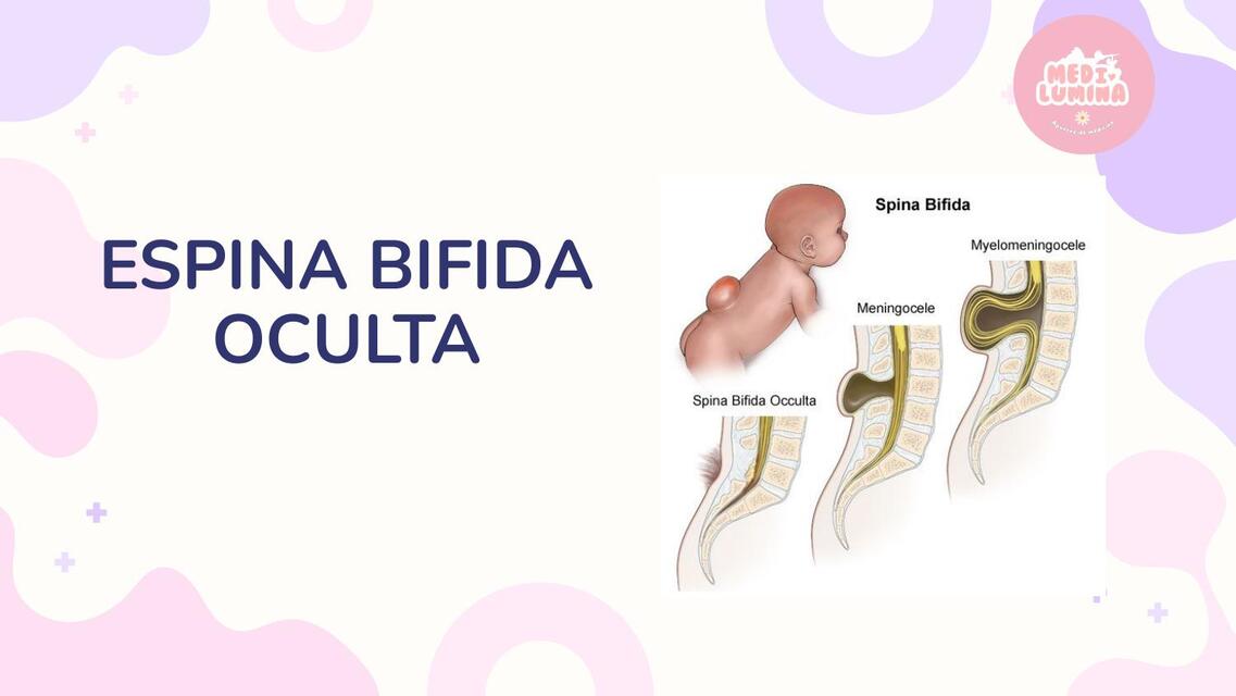 ESPINA BIFIDA OCULTA | Medilumina | uDocz