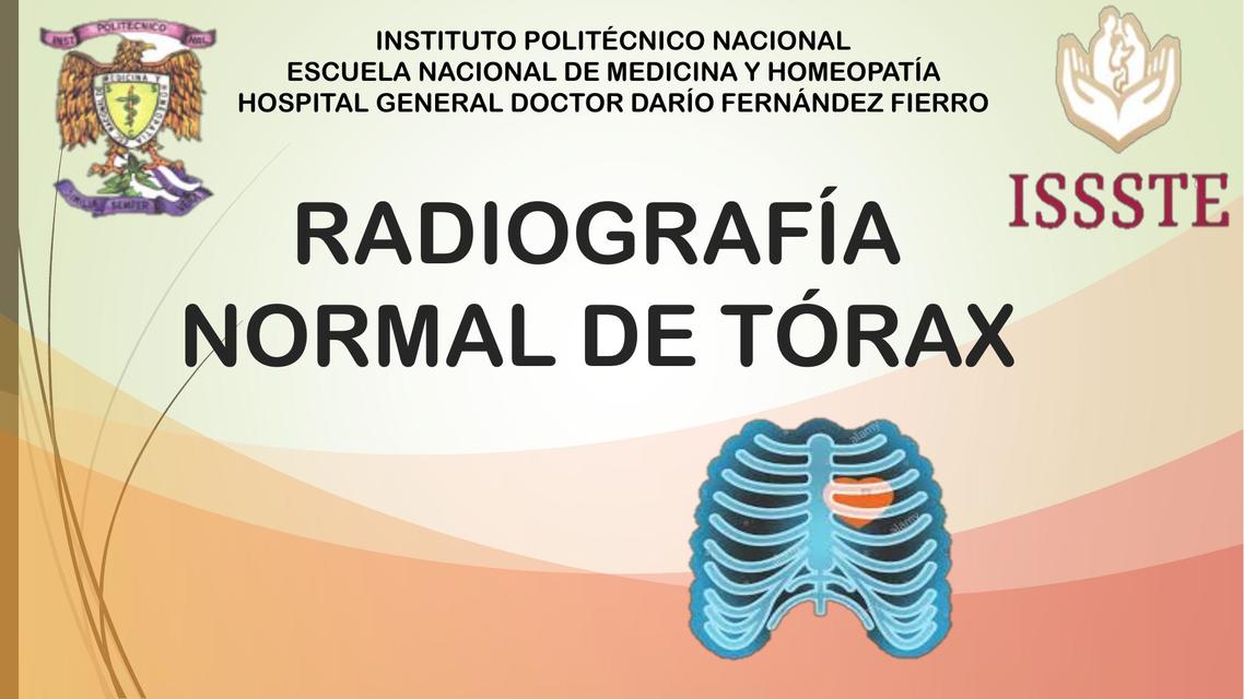 Radiografía normal de tórax | Medicine226 | uDocz