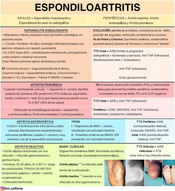 ESPONDILOARTRITIS | Dr. Boris Moises Caillares Montaño | uDocz