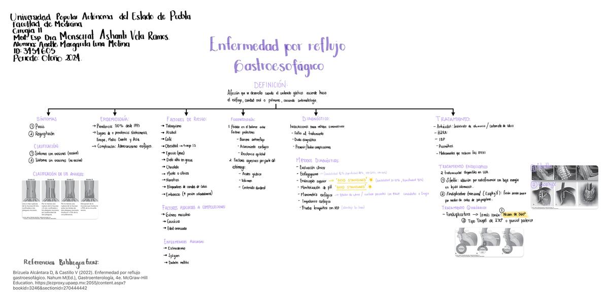 ERGE | ANETTE LUNA | uDocz