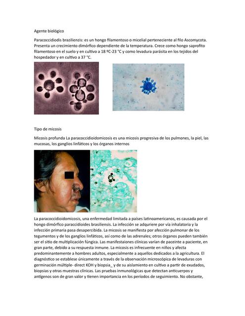 Agente biológico | emely santiago | uDocz