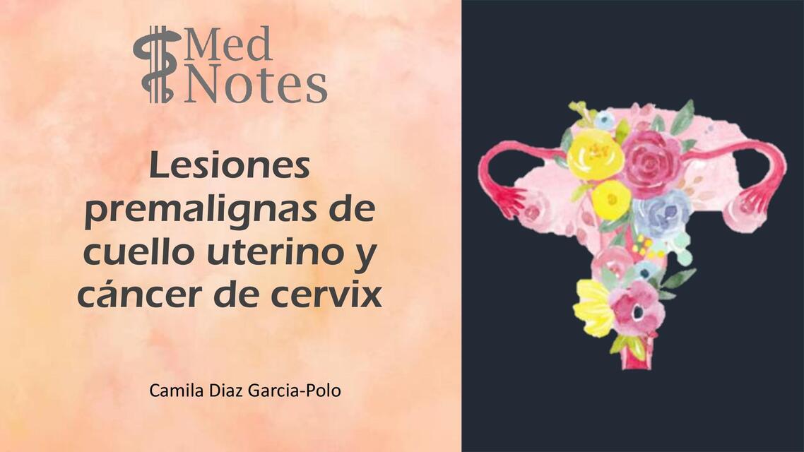 Ca cervix | Step | uDocz